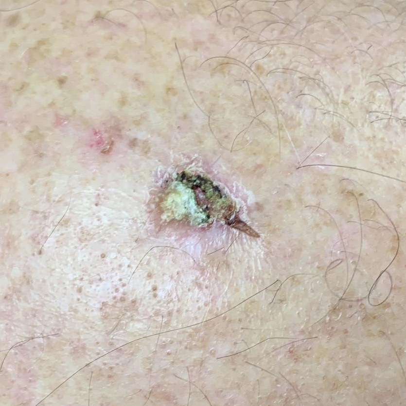 Treatments - Dermatology Associates of Lincoln